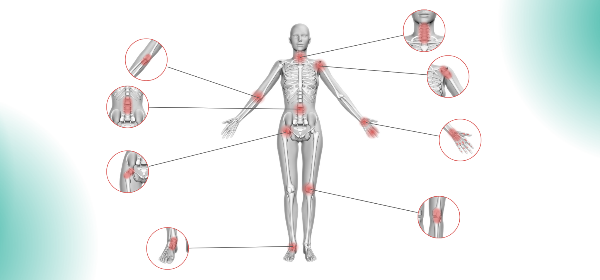 Arthrose: Ursachen, Symptome, Behandlung | BALANCE 7